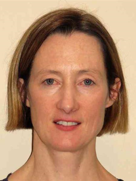 Dr Sophie Weatherhead - Newcastle Hospitals NHS Foundation Trust