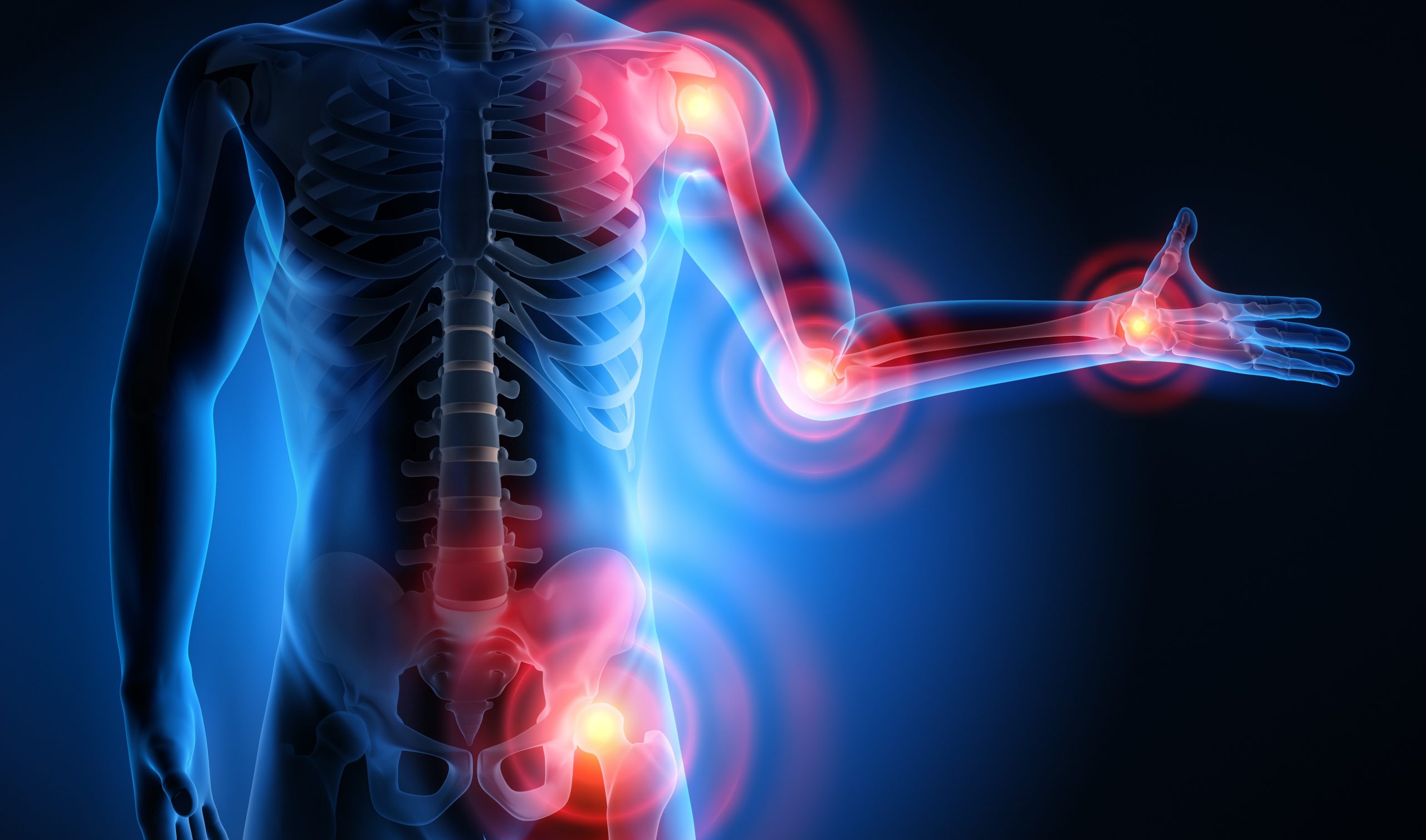 Rheumatology - Newcastle Hospitals NHS Foundation Trust