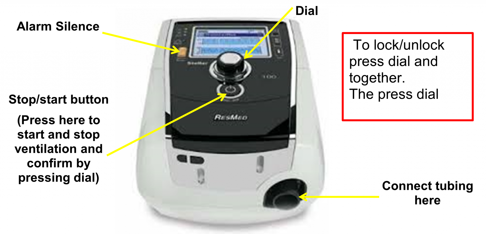 Resmed Stellar 150 - Newcastle Hospitals NHS Foundation Trust