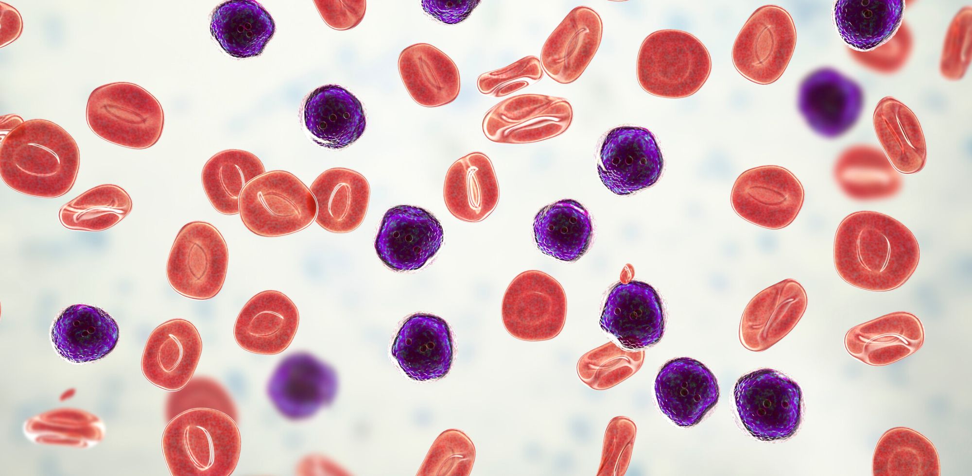 Leukaemia research could help inform most effective treatment for ...