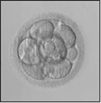 What happens during IVF - Newcastle Hospitals NHS Foundation Trust