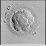 What happens during IVF - Newcastle Hospitals NHS Foundation Trust
