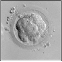 What happens during IVF - Newcastle Hospitals NHS Foundation Trust