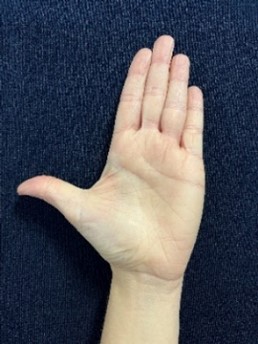 Wrist Pain - Newcastle Hospitals NHS Foundation Trust