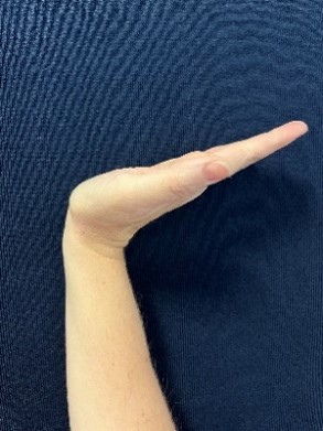 Wrist Pain - Newcastle Hospitals NHS Foundation Trust