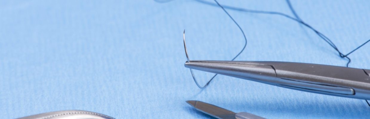 Mohs surgery - what to expect - Newcastle Hospitals NHS Foundation Trust