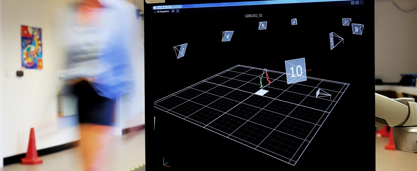 3D gait analysis - Newcastle Hospitals NHS Foundation Trust