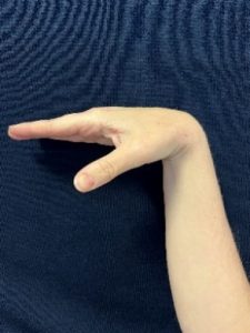 Wrist pain - Newcastle Hospitals NHS Foundation Trust