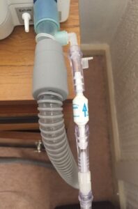 Nippy 3+ ventilator - Newcastle Hospitals NHS Foundation Trust