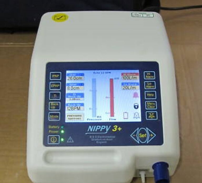 Nippy 3+ ventilator - Newcastle Hospitals NHS Foundation Trust