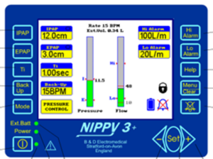 Nippy 3+ ventilator - Newcastle Hospitals NHS Foundation Trust