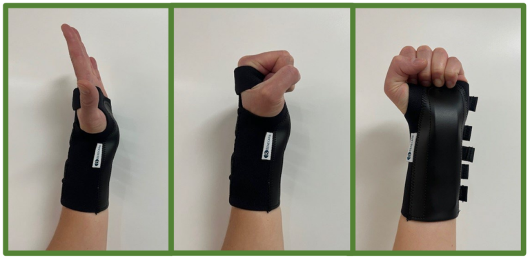 Instructions following application of a cast or splint to your wrist ...