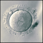 Fertility preservation (egg/embryo freezing) - Newcastle Hospitals NHS ...